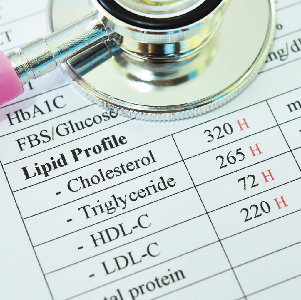 Understanding Cholesterol and Tips for High-Cholesterol Prevention ...