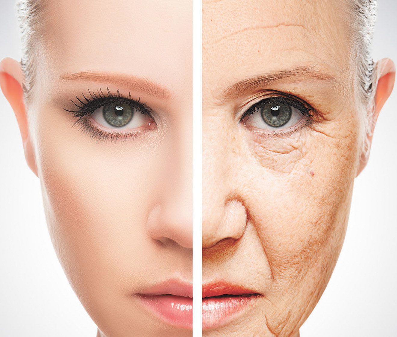 How Microneedling Can Help Restore Collagen | Central Florida Health ...