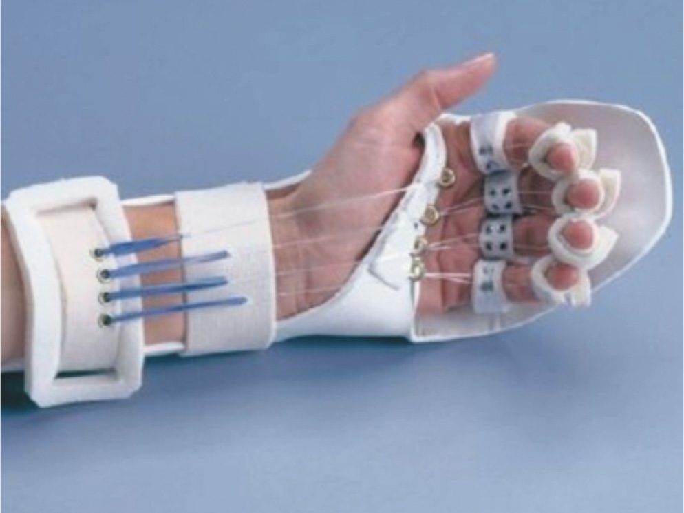 Why Choose a Certified Hand Therapist or CHT for Your Upper Extremity ...