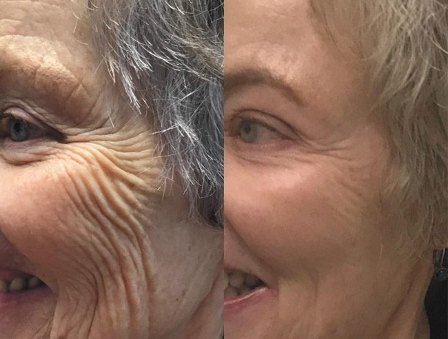 FACT OR FICTION: Aesthetic Myths and Misconceptions | Central Florida ...