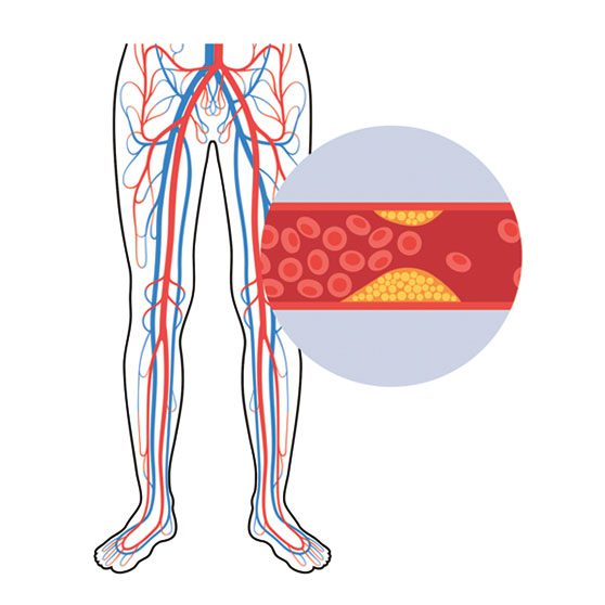 Tight Skin on Your Legs? Understanding Circulation and Vein Problems ...